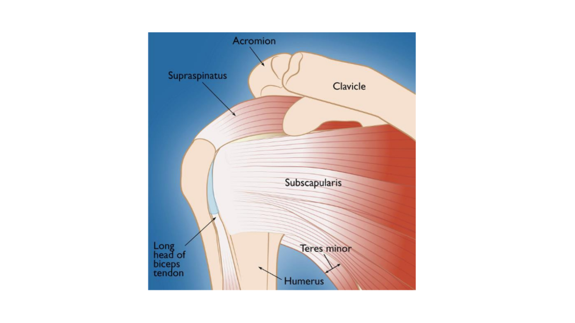 Cuff is Key: Why Shoulder Rehab Needs Consistency