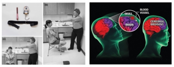 Concussion prevention through strengthening, can it work?